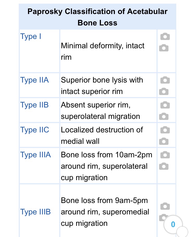 Paprosky classification of Femoral and Acetabular bone loss – Let's ...